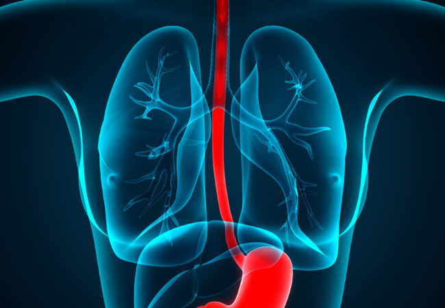 Οισοφάγος :: giorgakismed.gr